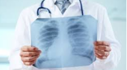 X-Ray Mastery | Boolean Strings