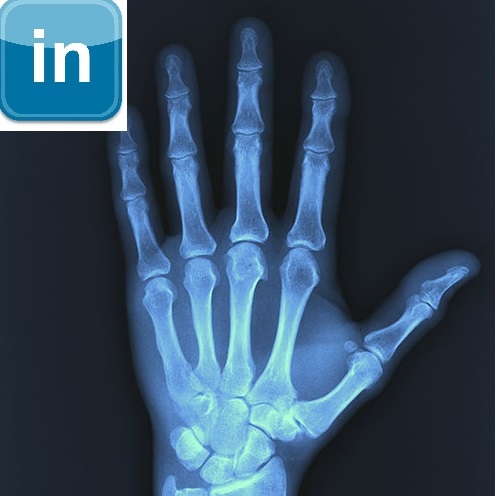20 LinkedIn Profile X-ray Strings for 2022 | Boolean Strings